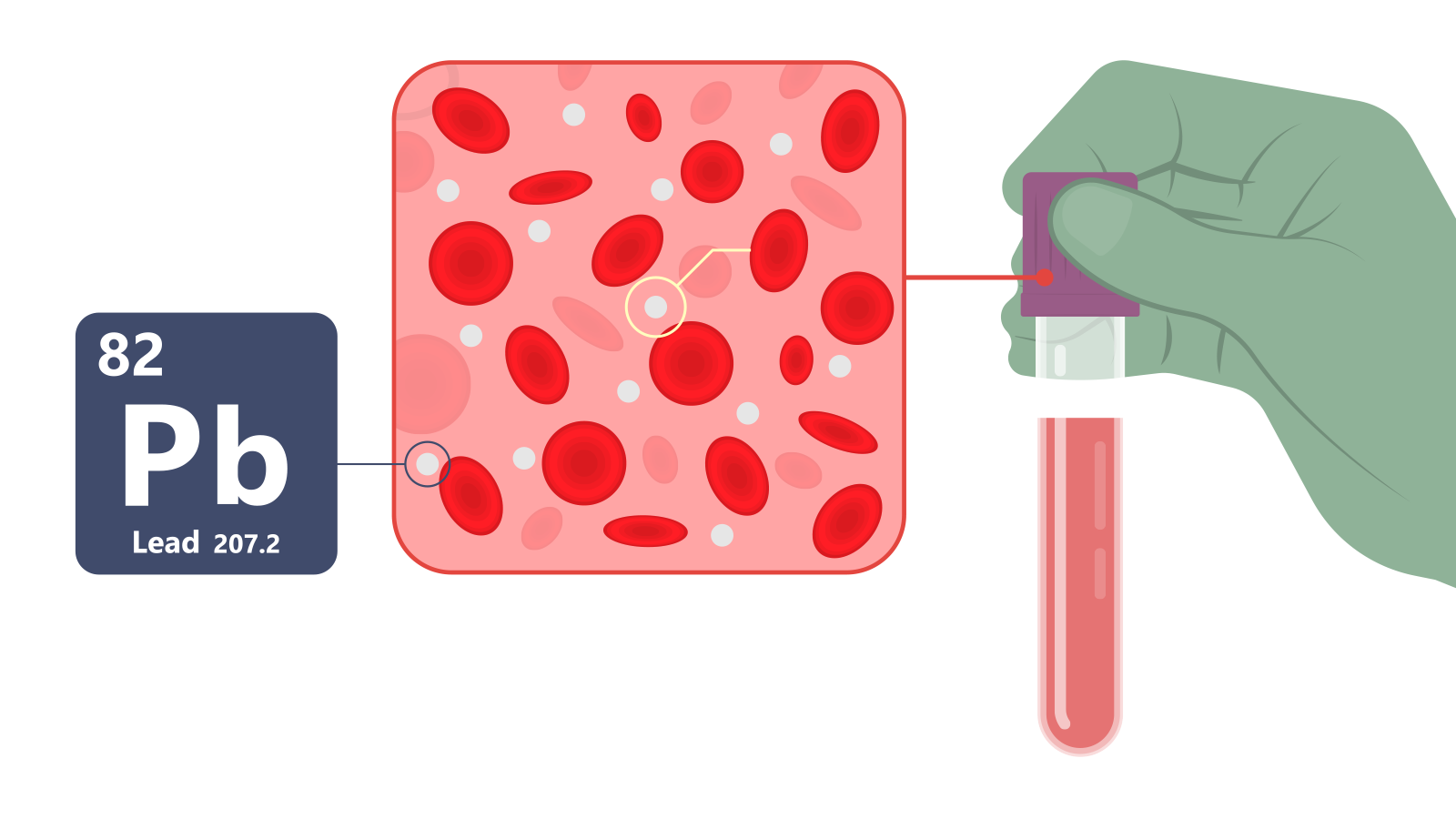 Protecting Kids from Lead Exposure